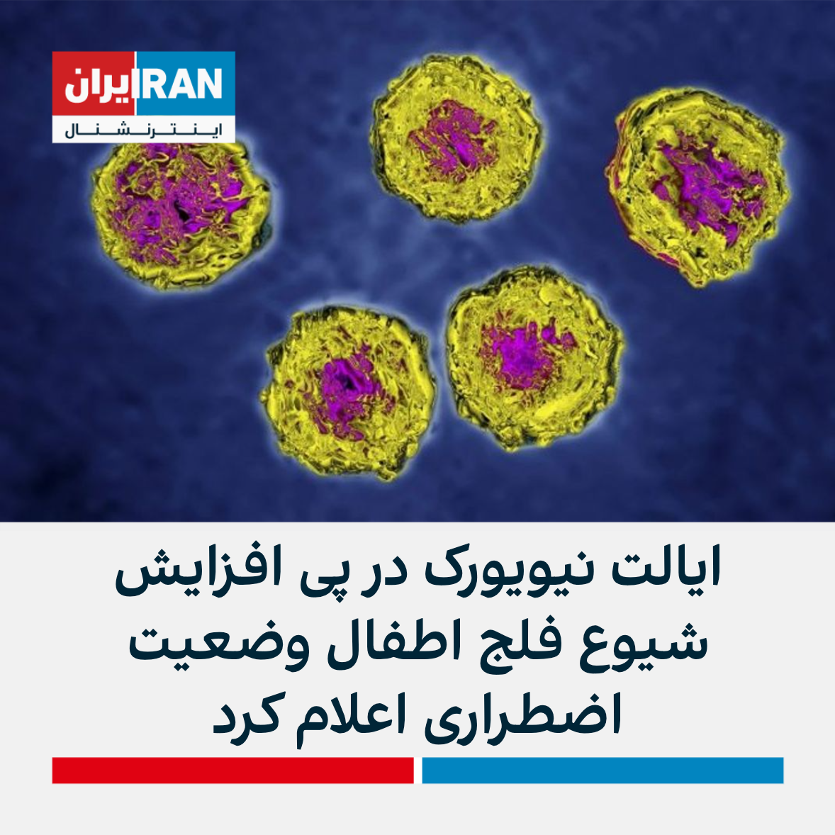 ایالت نیویورک در پی افزایش شیوع فلج اطفال وضعیت اضطراری اعلام کرد